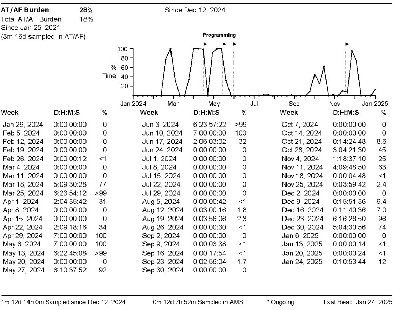 Afib Finally Shows Its Face | Forum | Pacemaker Club