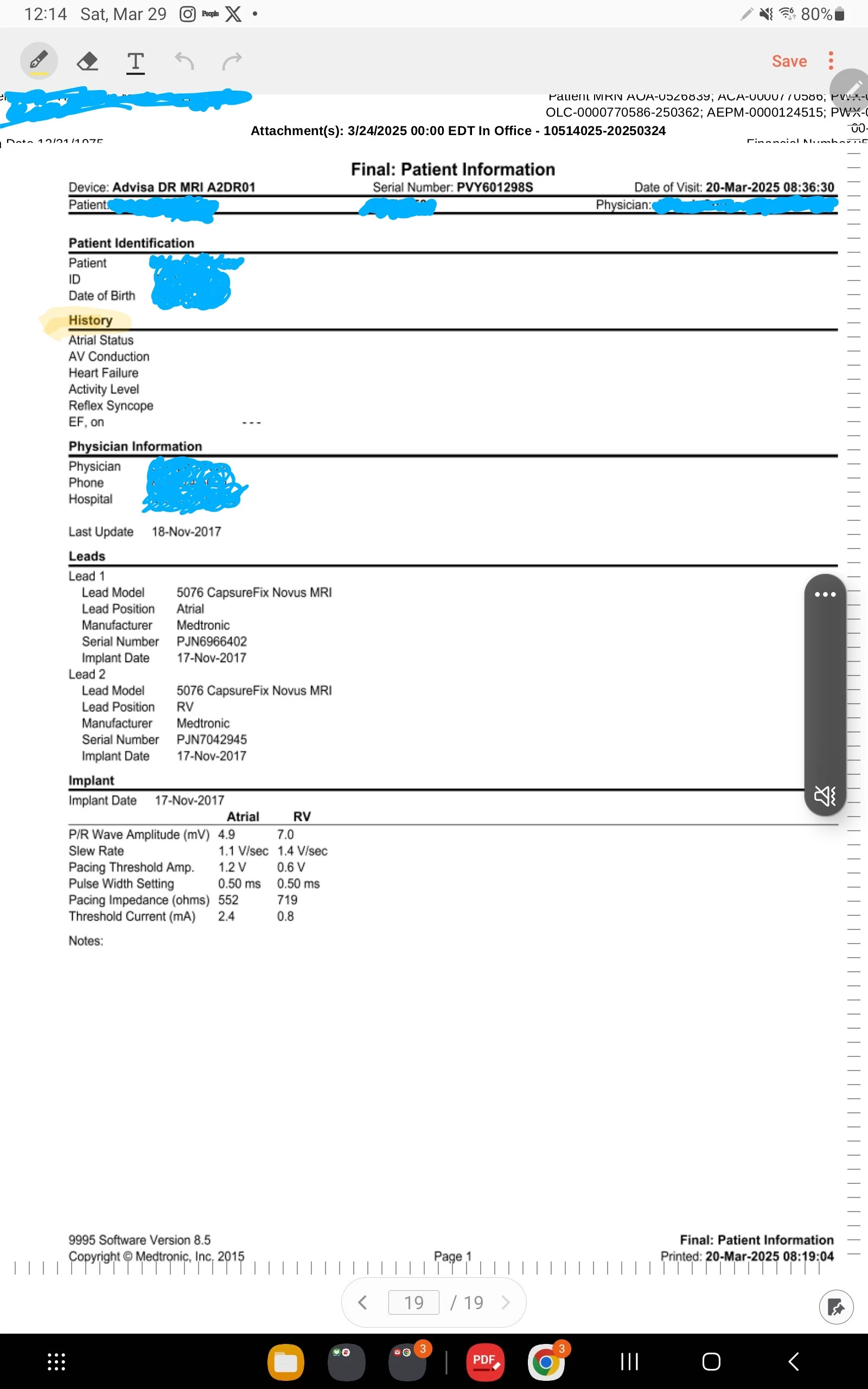 Pacemaker Club: Pacemaker interrogation Report