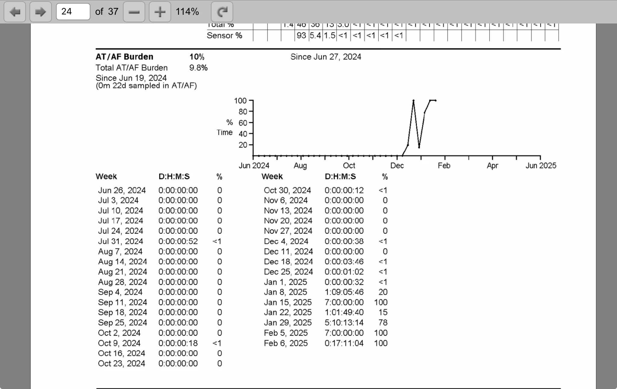 Afib Finally Shows Its Face | Forum | Pacemaker Club